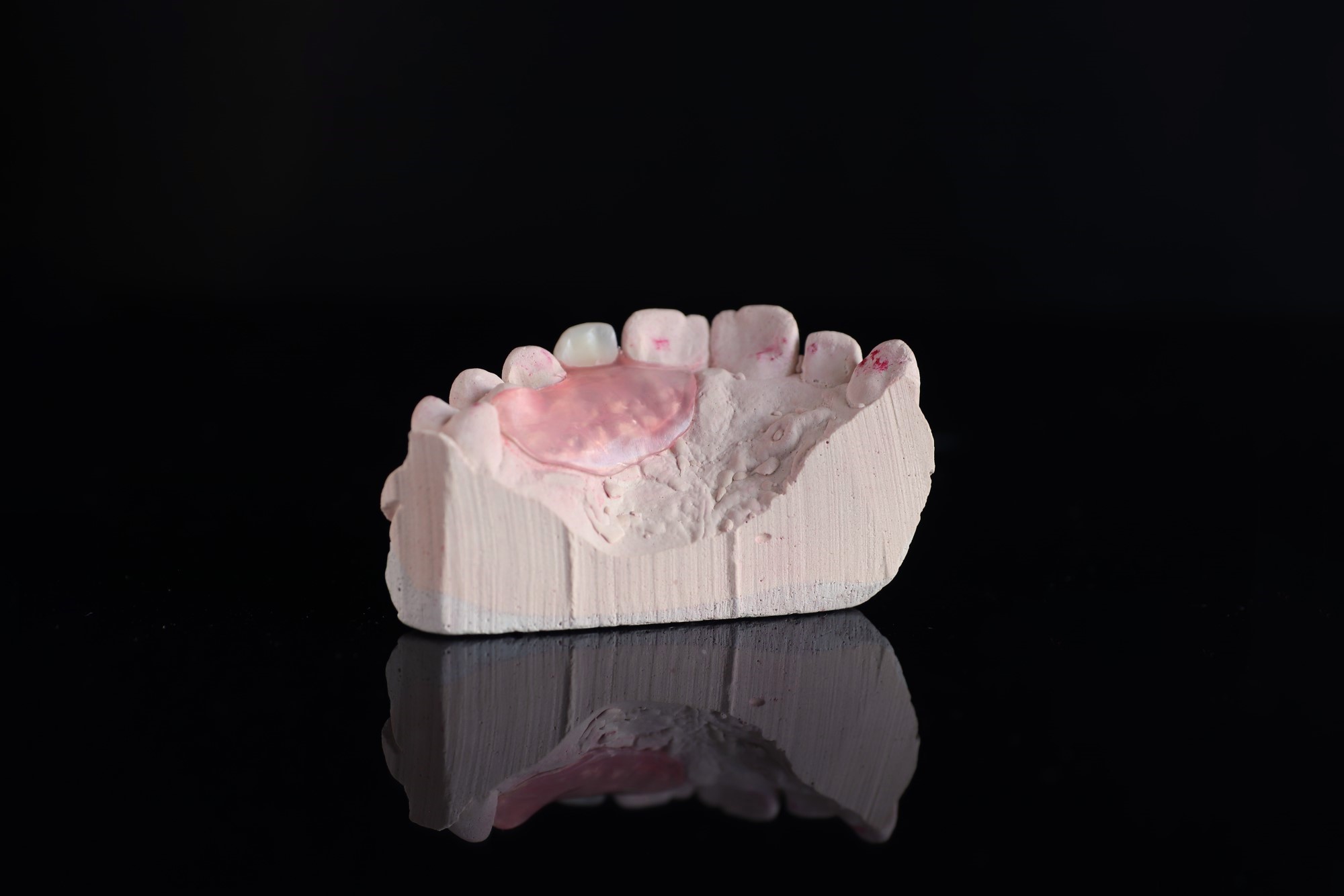 PK Dent - Valplast fogsor